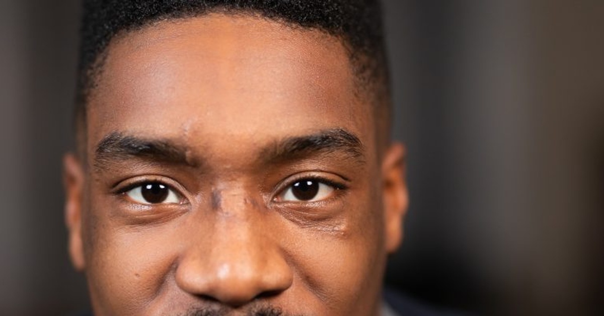 Patrick Emmanuel Abellard - Comédien